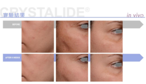 亮白成分- Crystalide™女神水晶高光肽 – MIT保養代工｜台灣險峰生物